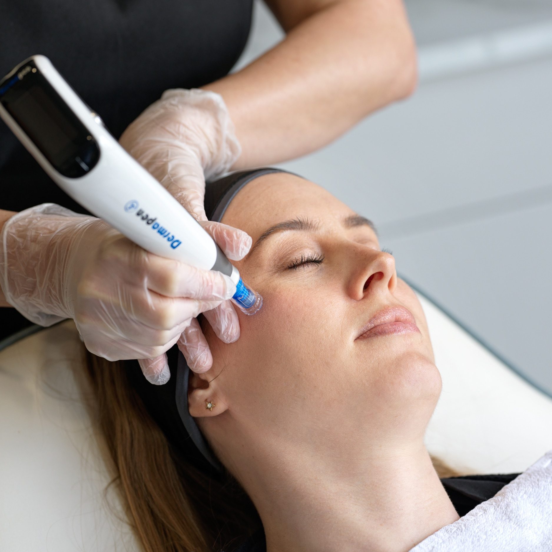 Dermapen Microneedling: Best for Collagen Induction from £200.